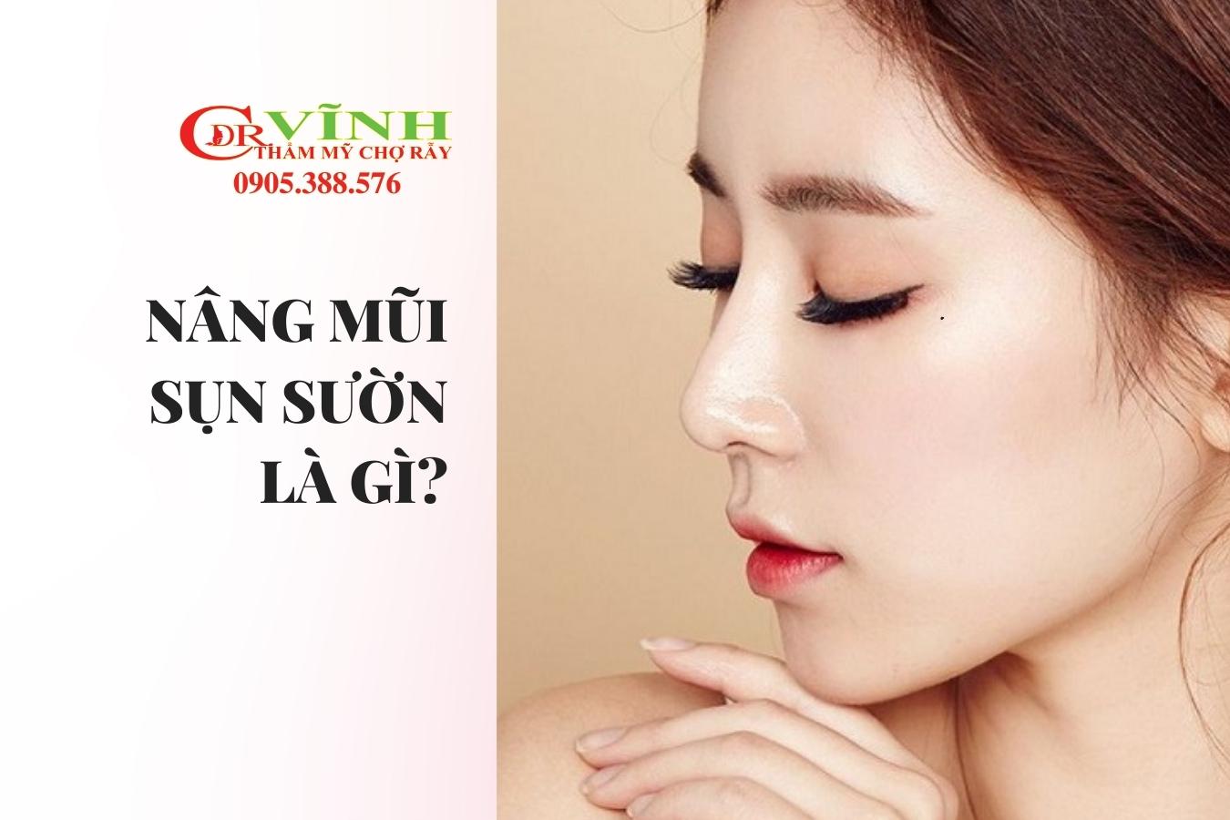 Nâng mũi sụn sườn là gì? Nâng mũi an toàn - Bác sĩ thẩm mỹ Chợ Rẫy