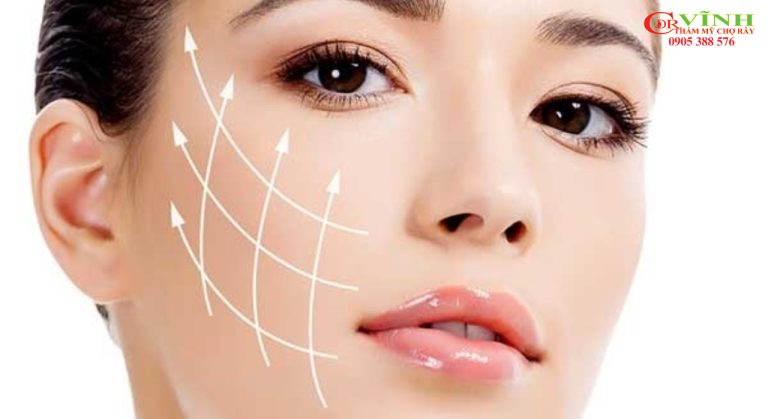 Phẫu thuật căng da mặt bao nhiêu tiền? Giá cập nhật 2025
